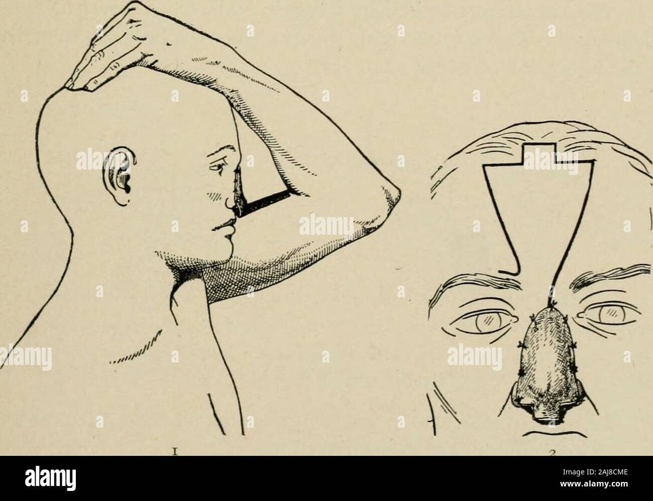 Plastic surgery; its principles and practice . ose by the modified ...