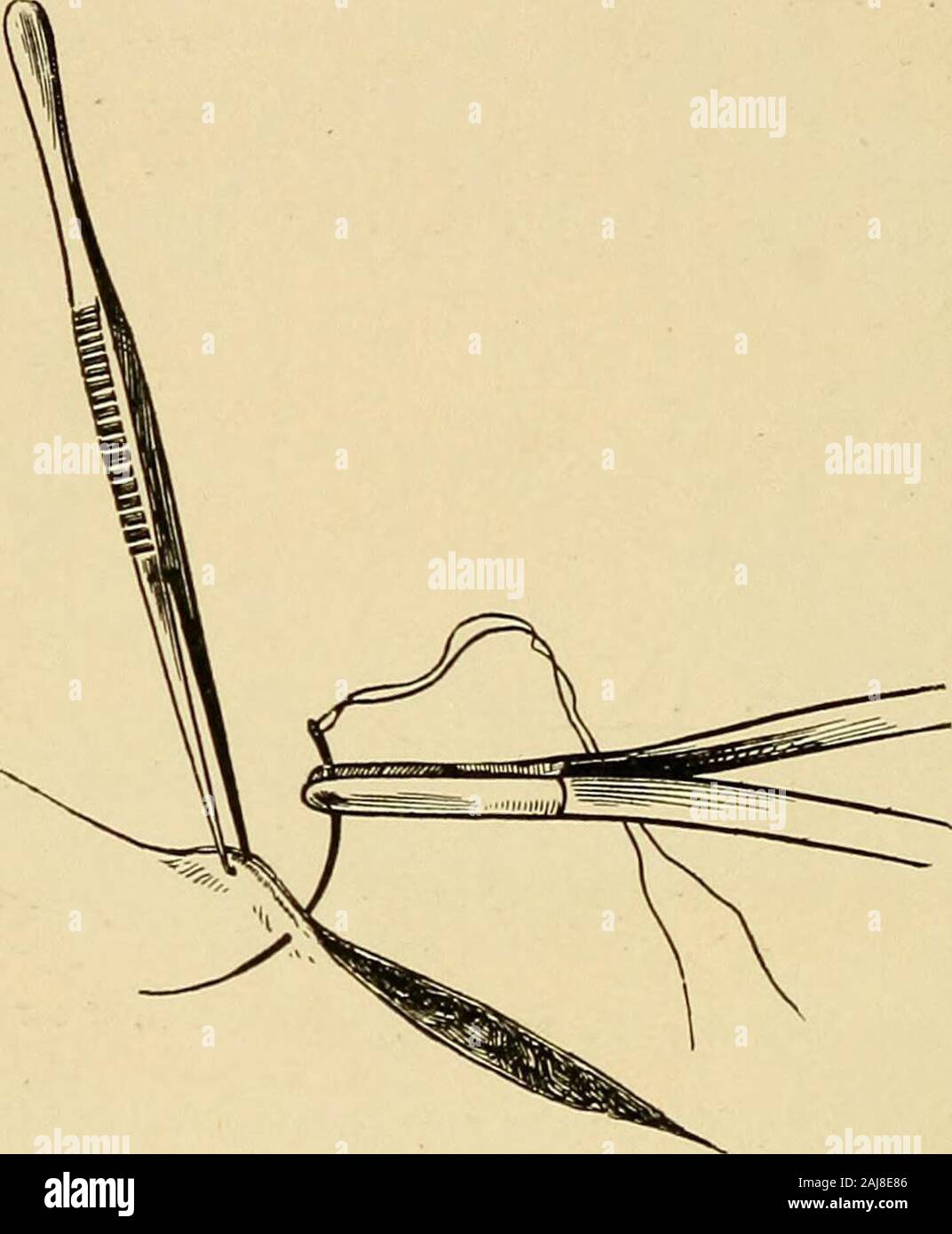 The surgical assistant, a manual for students, practitioners, hospital ...