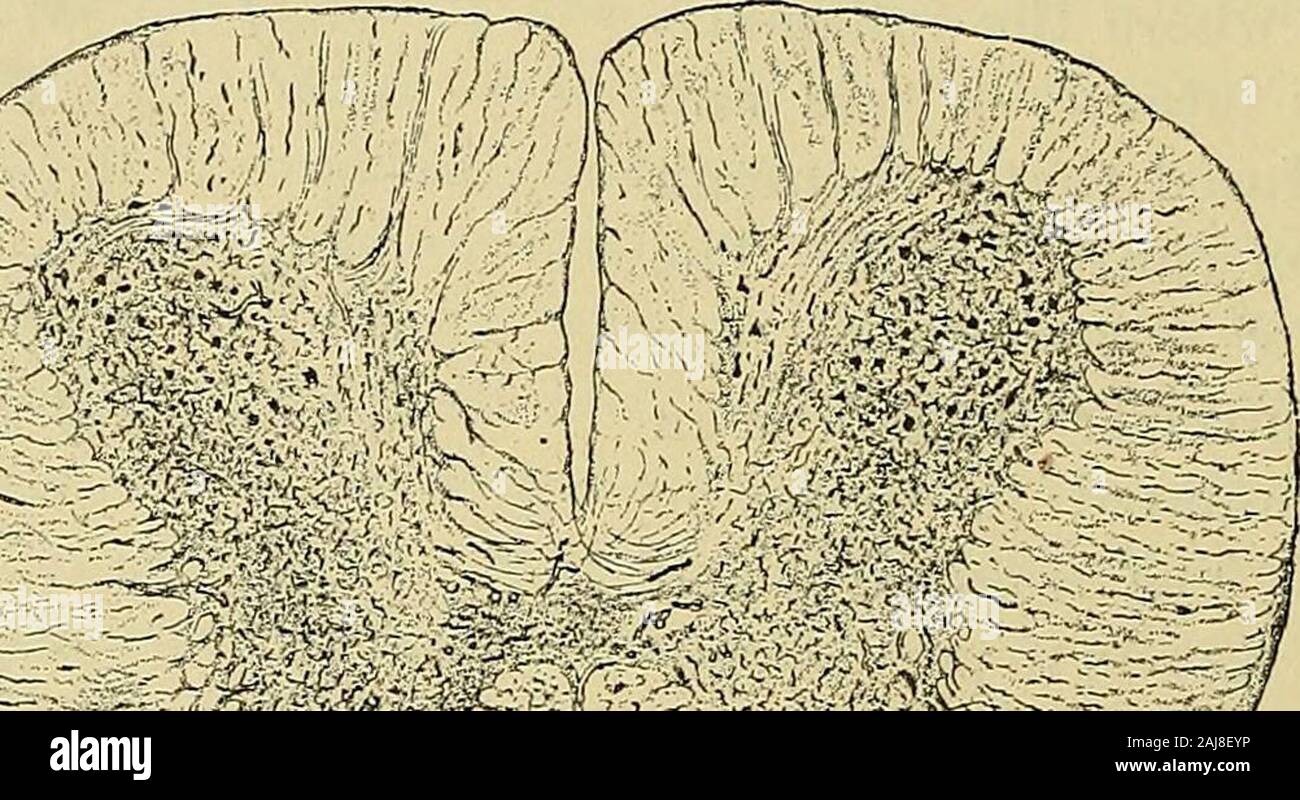 A manual of diseases of the nervous system . ngled, round,fusiform ...
