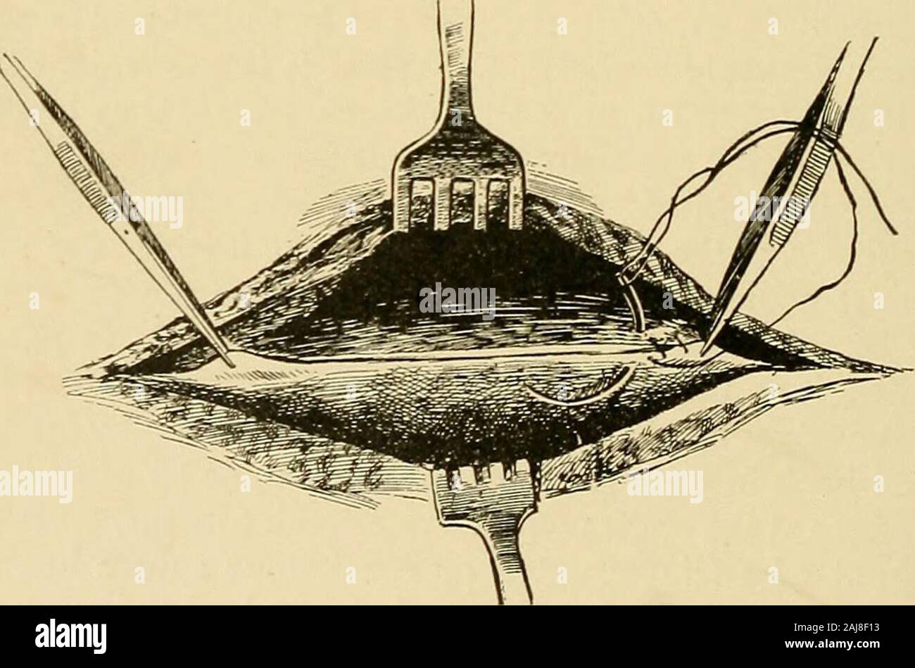 The surgical assistant, a manual for students, practitioners, hospital ...