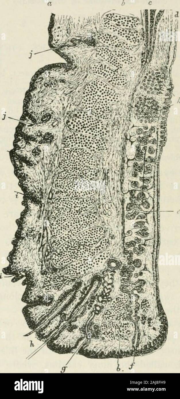 Symblepharon hi-res stock photography and images - Alamy