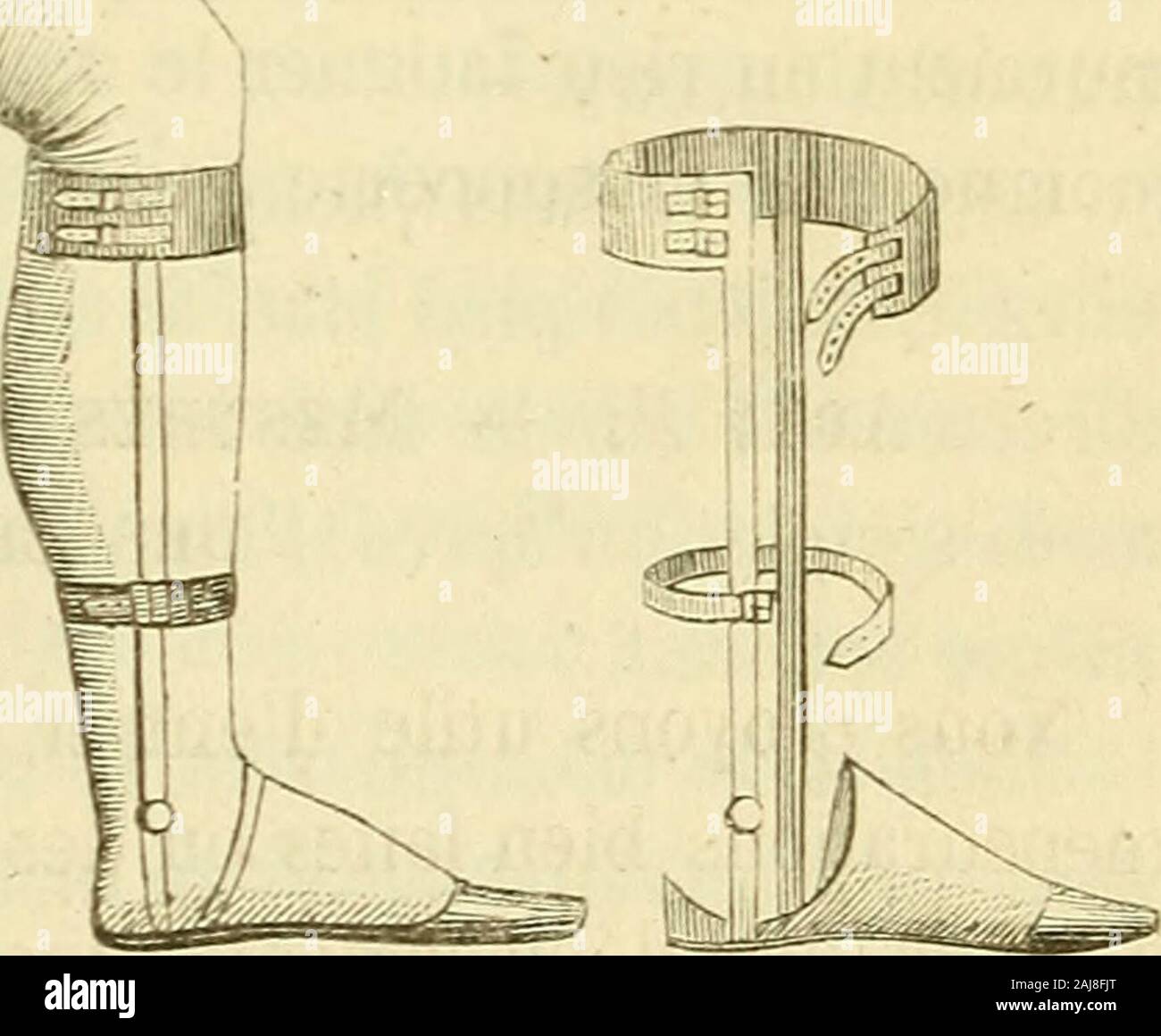 Les os du tarse hi-res stock photography and images - Alamy