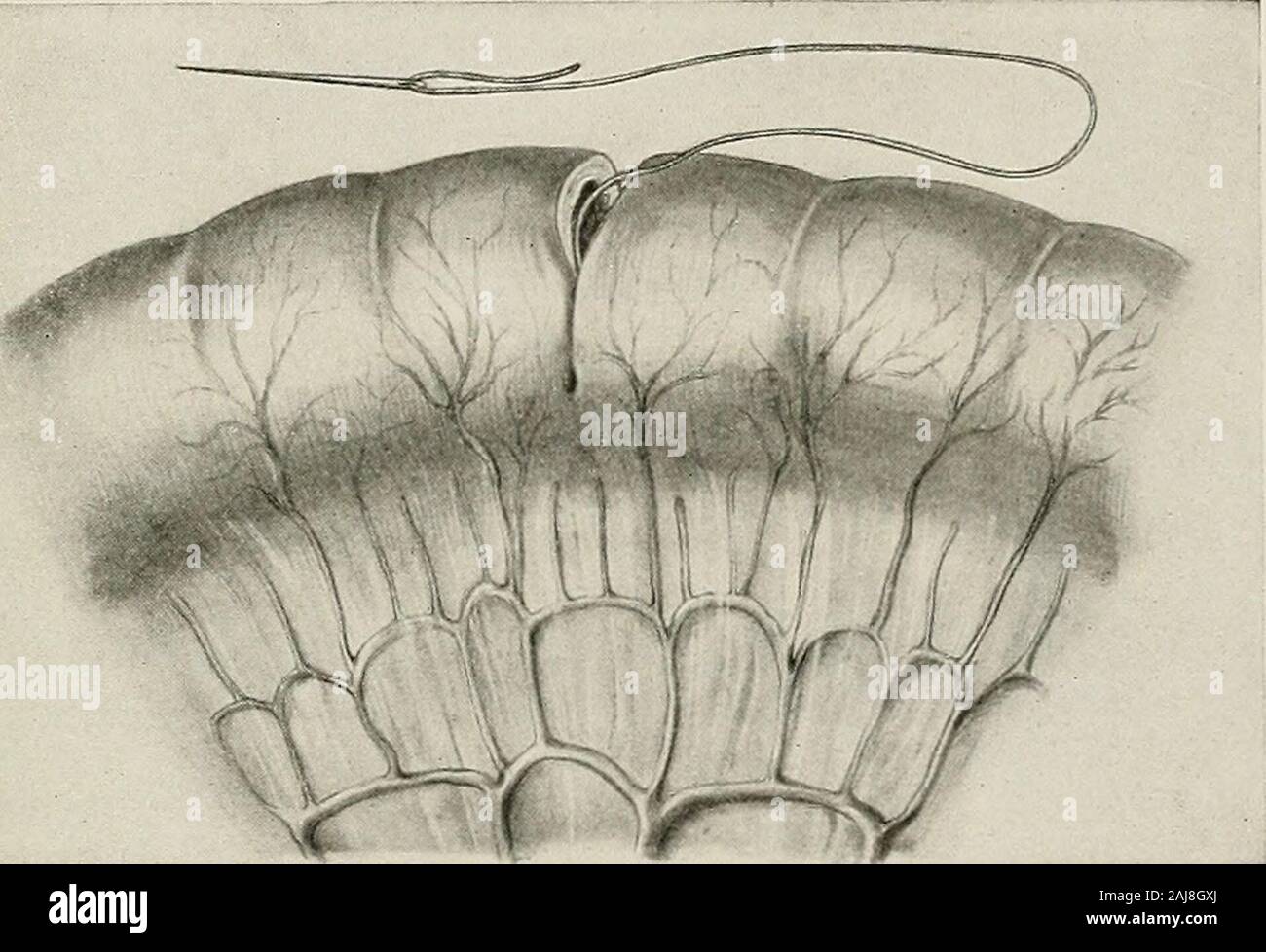 Occlusive dressing hi-res stock photography and images - Alamy
