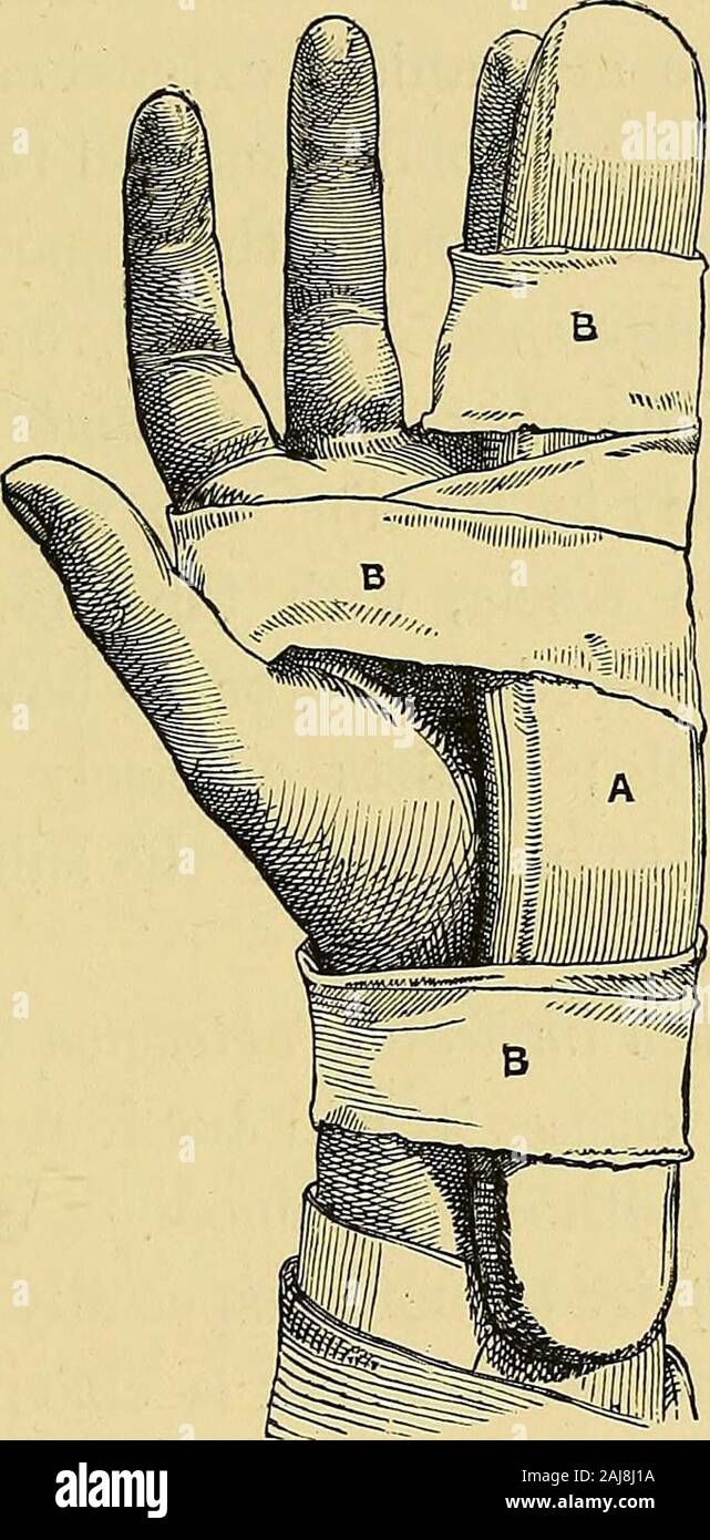 Contracted toe hi-res stock photography and images - Alamy