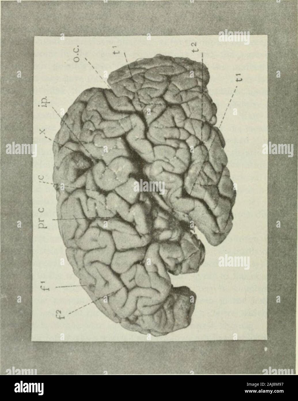 Brocas convolution hi-res stock photography and images - Alamy