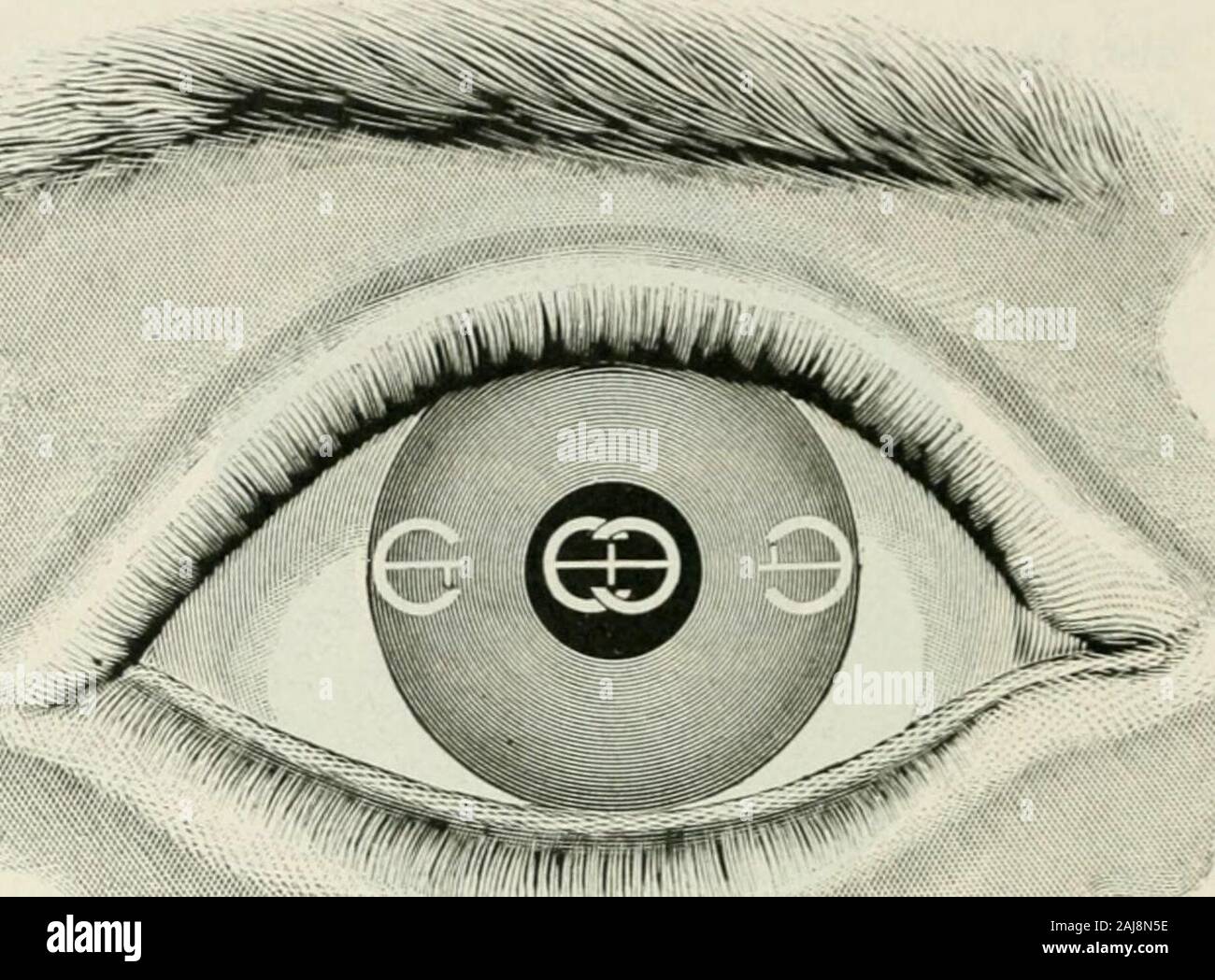 The commoner diseases of the eye : how to detect and how to treat them ...