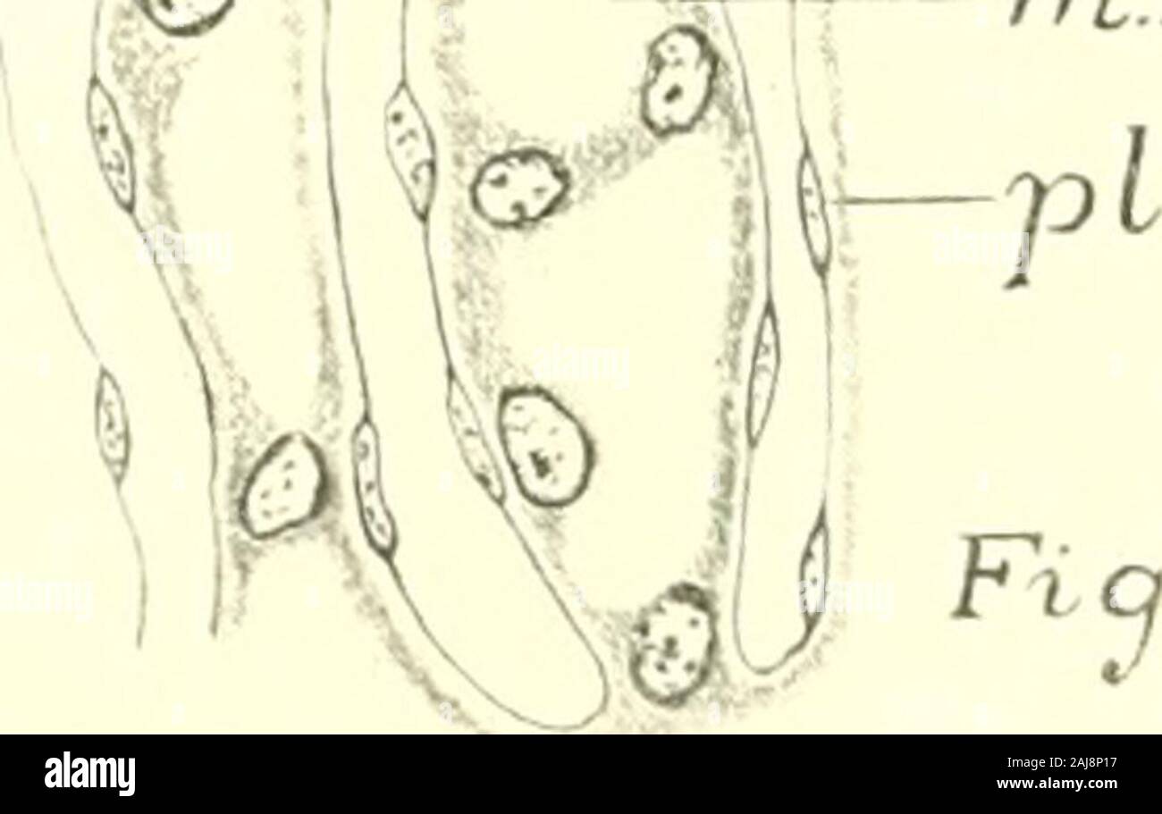 Chorionic plate hi-res stock photography and images - Alamy