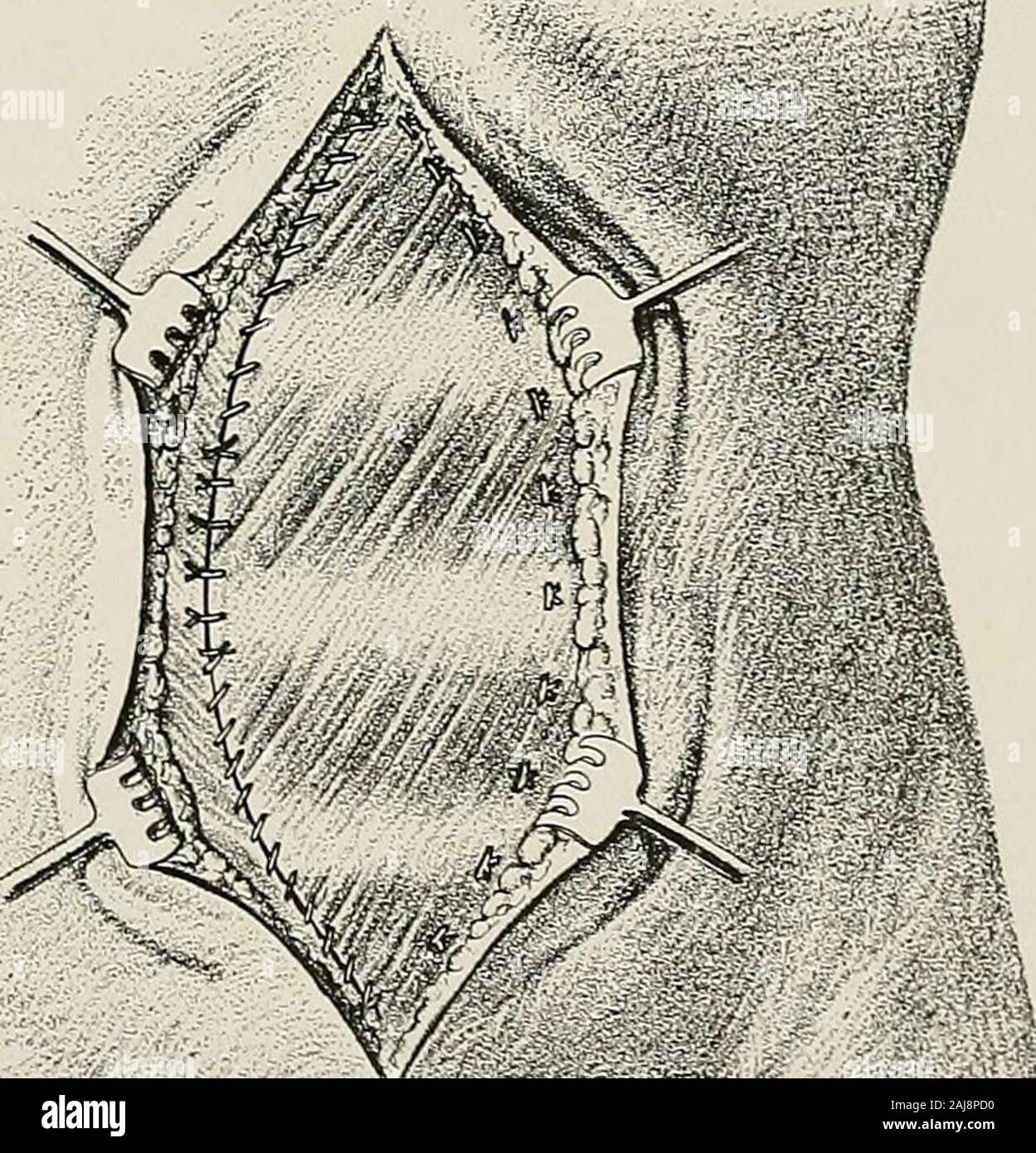 Surgical treatment; a practical treatise on the therapy of surgical ...