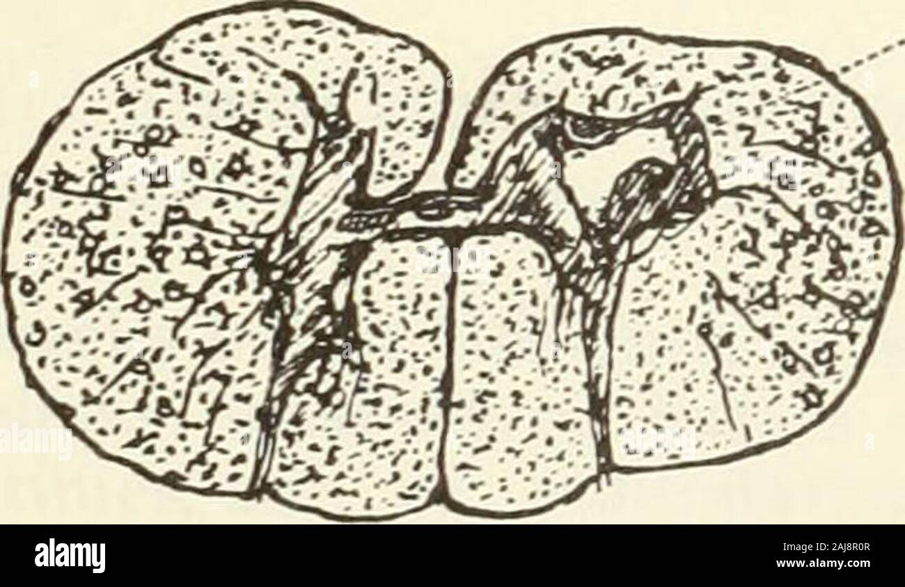 The Journal of nervous and mental disease . Cavity. Fig. 2.—Middle ...