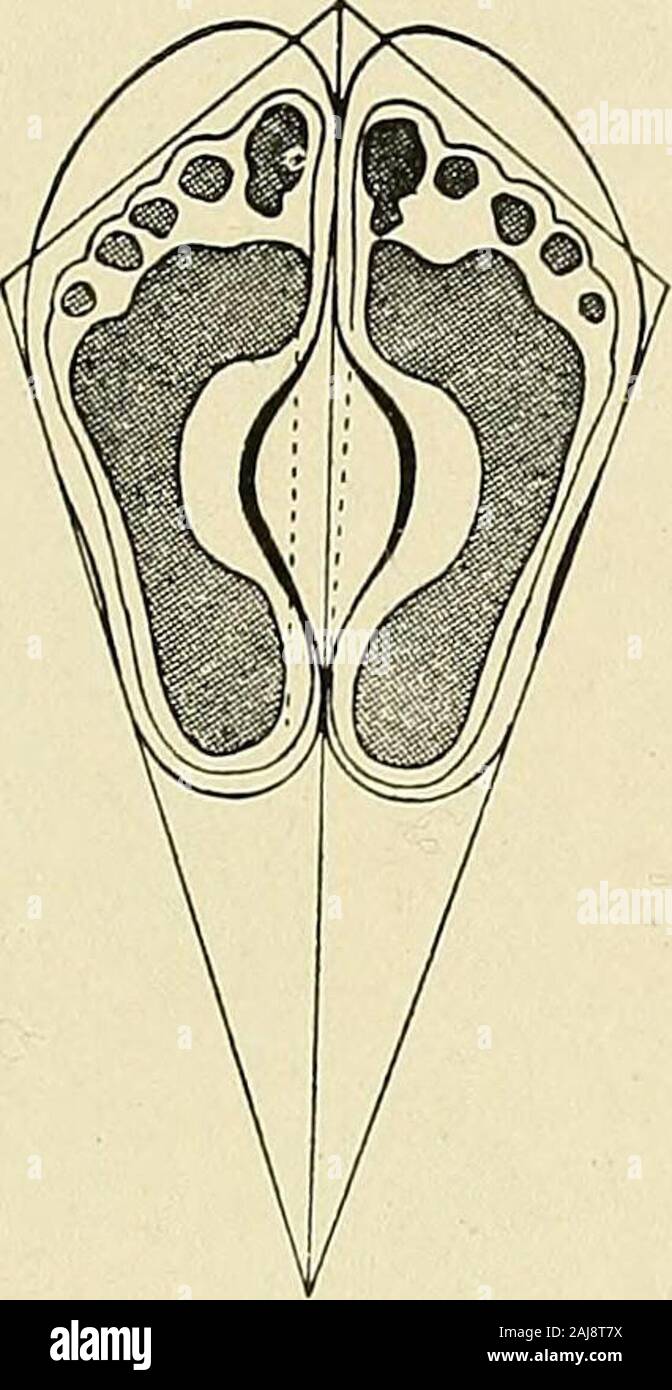 Orthopedic shoemaker hi-res stock photography and images - Alamy