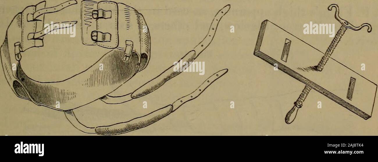Extension fractures hi-res stock photography and images - Alamy