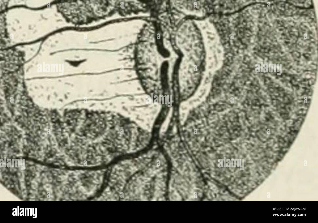 Progressive stretching hi-res stock photography and images - Alamy