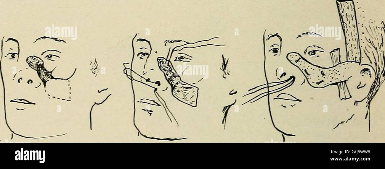 Hinged flap hi-res stock photography and images - Alamy