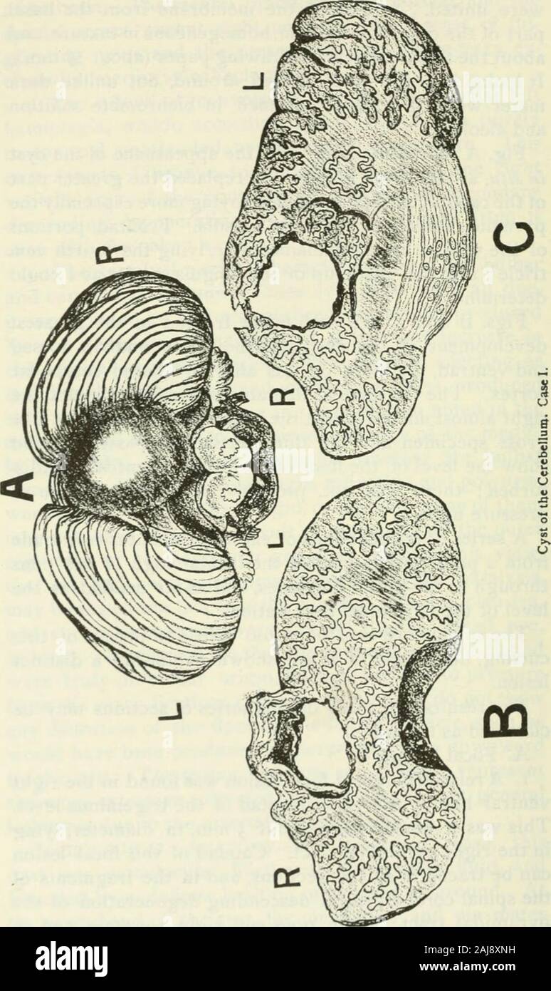 Transections hi-res stock photography and images - Alamy
