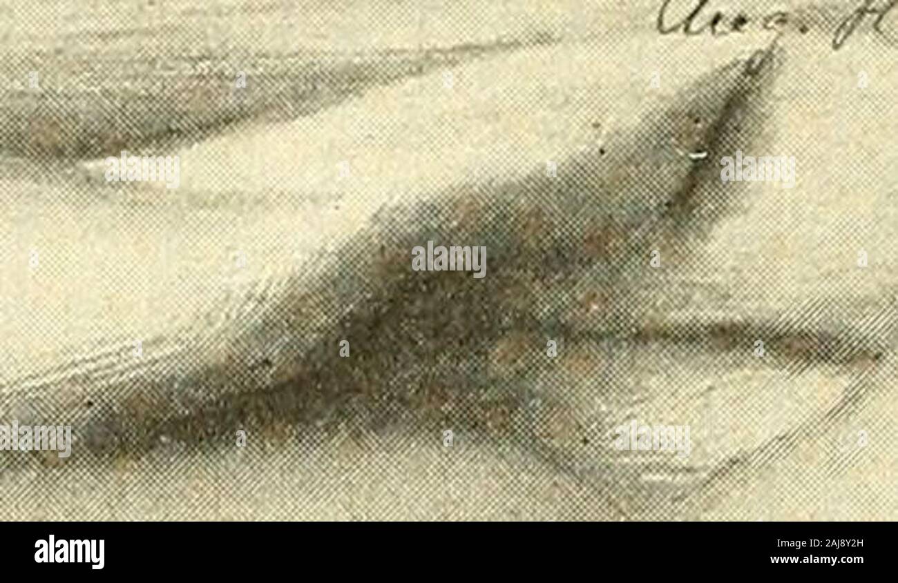 Operative gynecology : . HH>