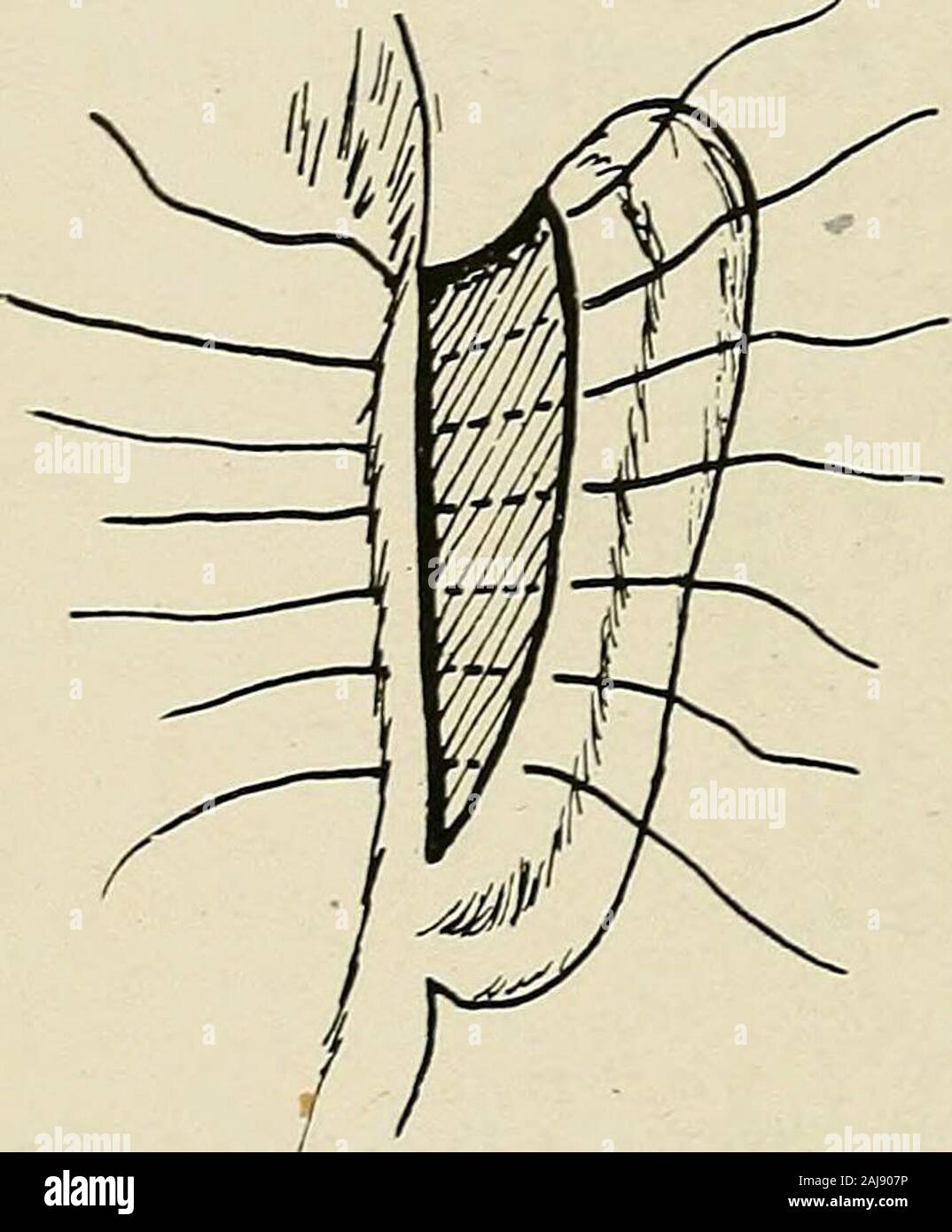 Plastic surgery; its principles and practice . one piece of ...