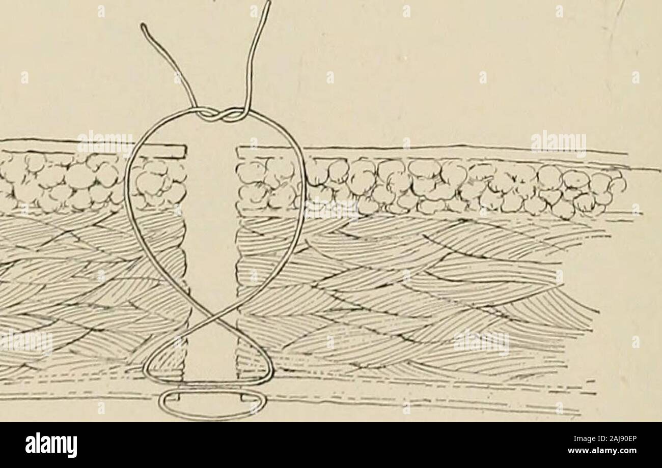 Surgical treatment; a practical treatise on the therapy of surgical ...