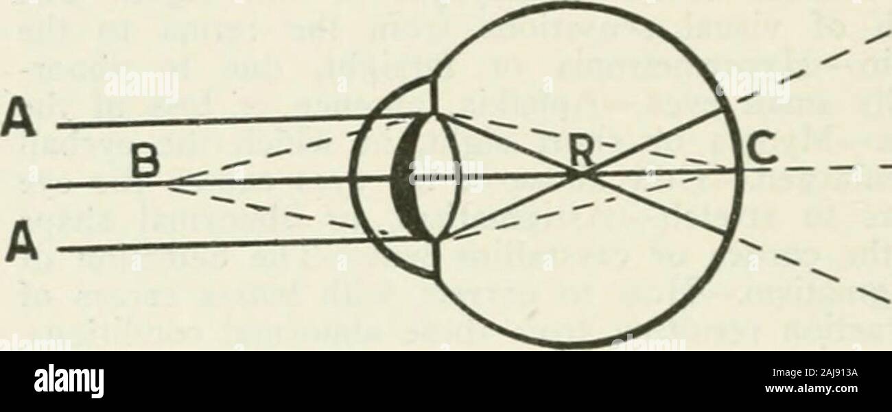 The commoner diseases of the eye : how to detect and how to treat them ...
