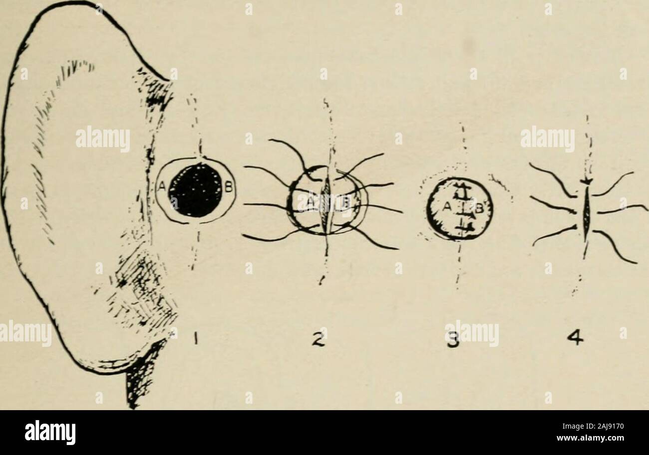 Plastic surgery; its principles and practice . 12 34 Fig. 422 ...