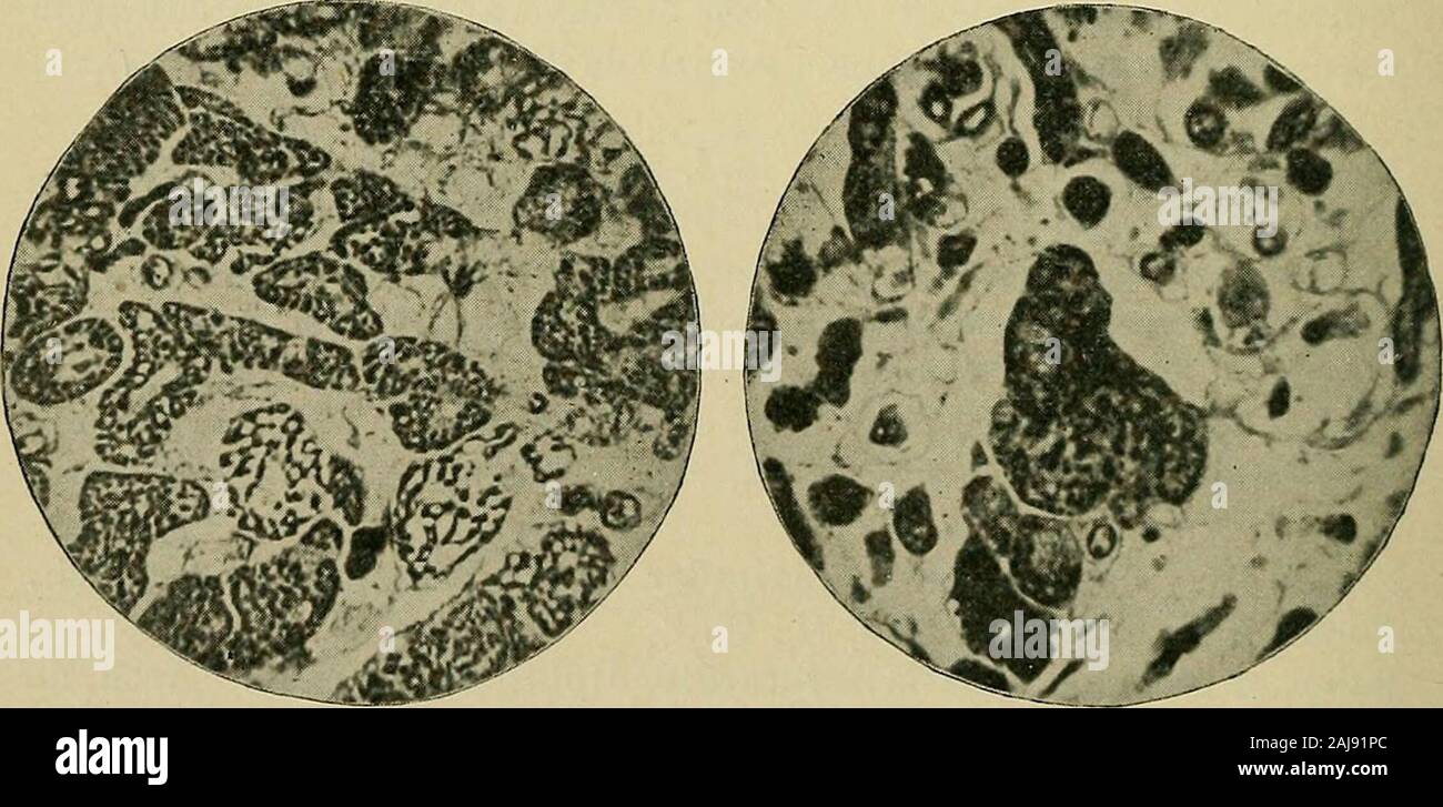 Plasma Cells Labeled