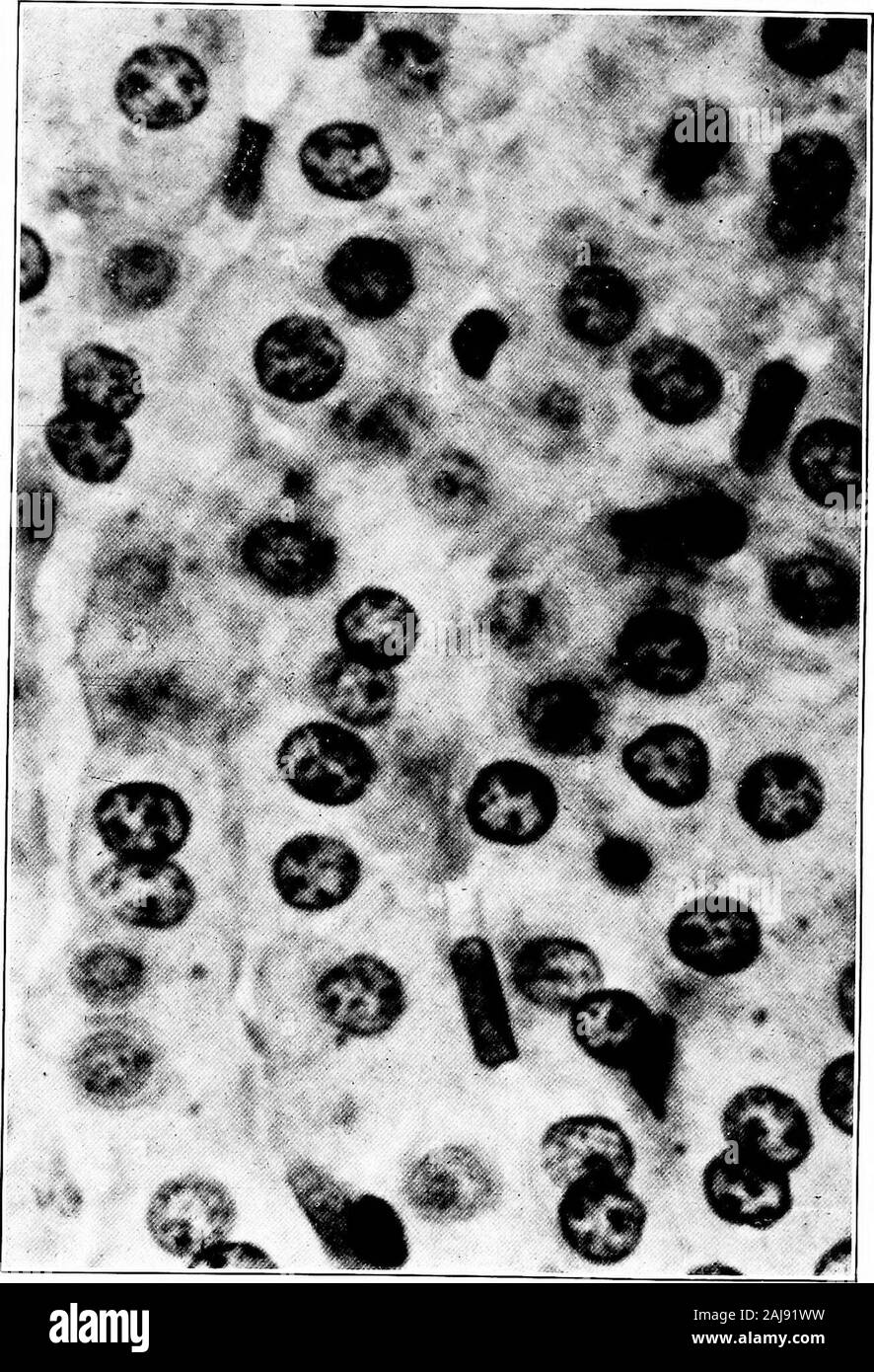 A mechanistic view of war and peace . B Section of adrenal of soldier ...