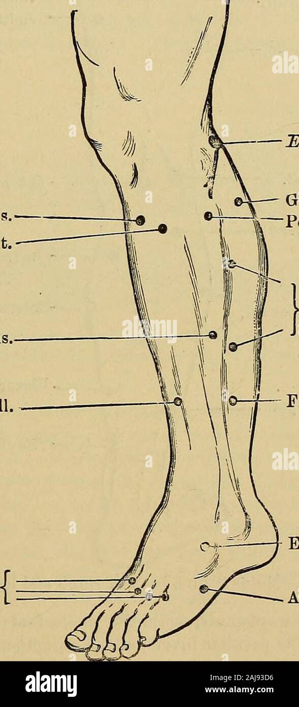 Leg Paralysis Patient