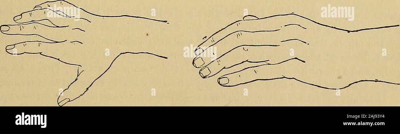 Arm with flexed muscles hi-res stock photography and images - Alamy