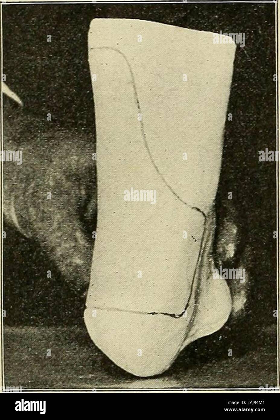 Os calcis hi-res stock photography and images - Alamy