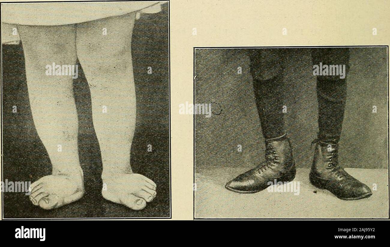 Bulging muscles hi-res stock photography and images - Alamy