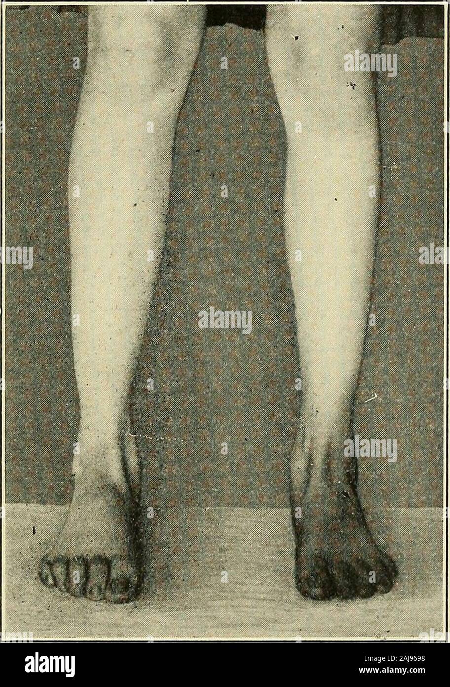 Slight concavity hi-res stock photography and images - Alamy
