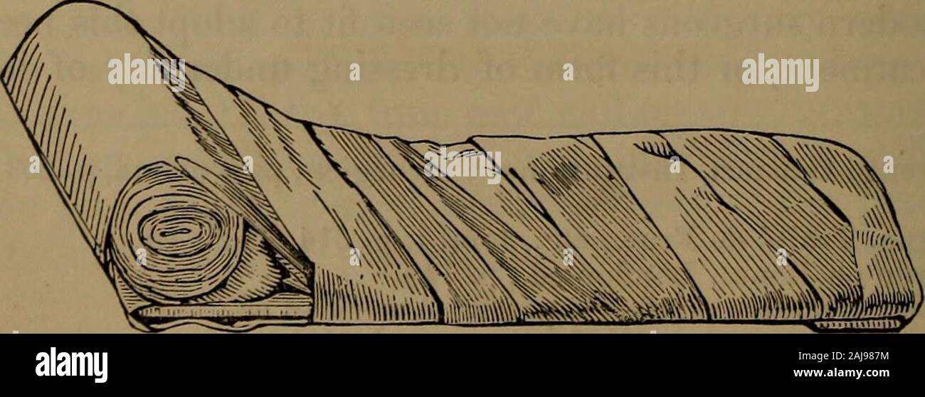 A practical treatise on fractures and dislocations . Bonds splint ...