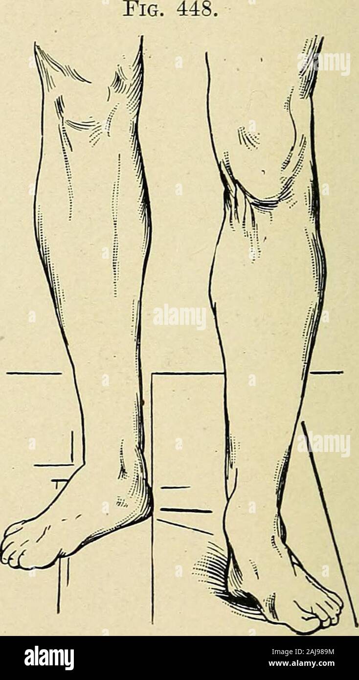 Outer body surgery hi-res stock photography and images - Alamy