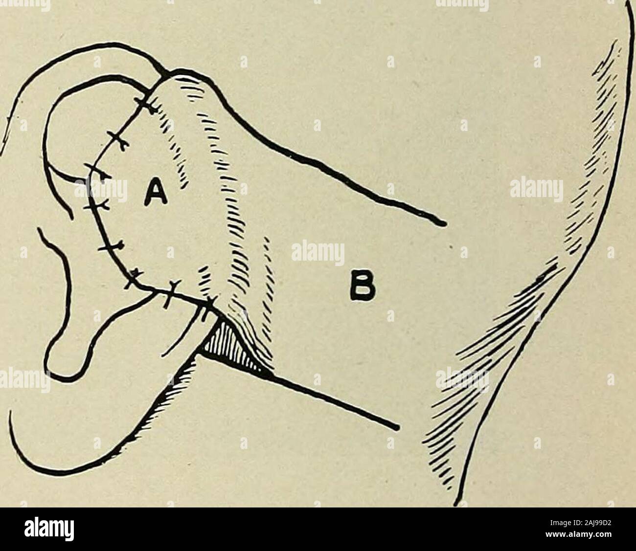 Sutured ear hi-res stock photography and images - Alamy