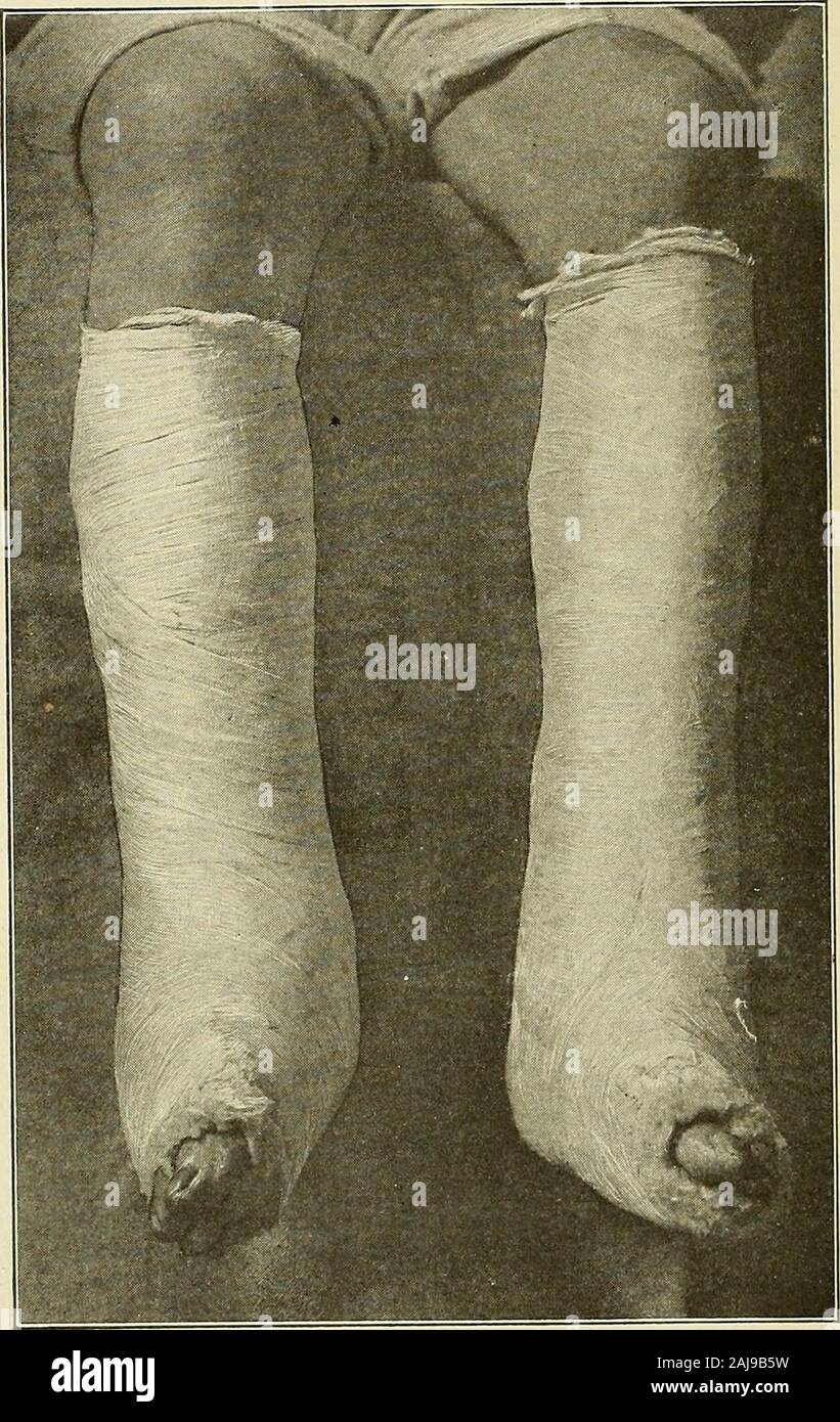 Inplaster hi-res stock photography and images - Alamy