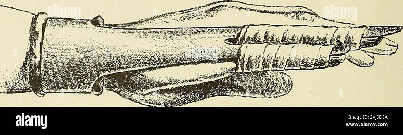 Preparatory and after treatment in operative cases . reatment and ...