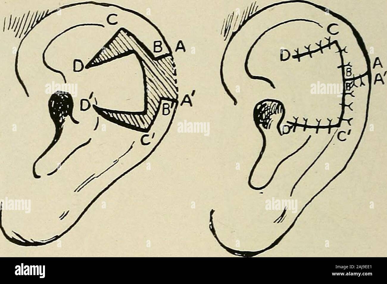 Ear Pointing Vs Ear Shaping