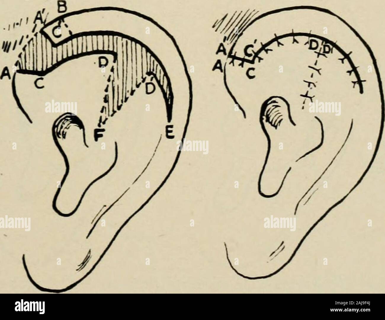 Ear Pointing Vs Ear Shaping