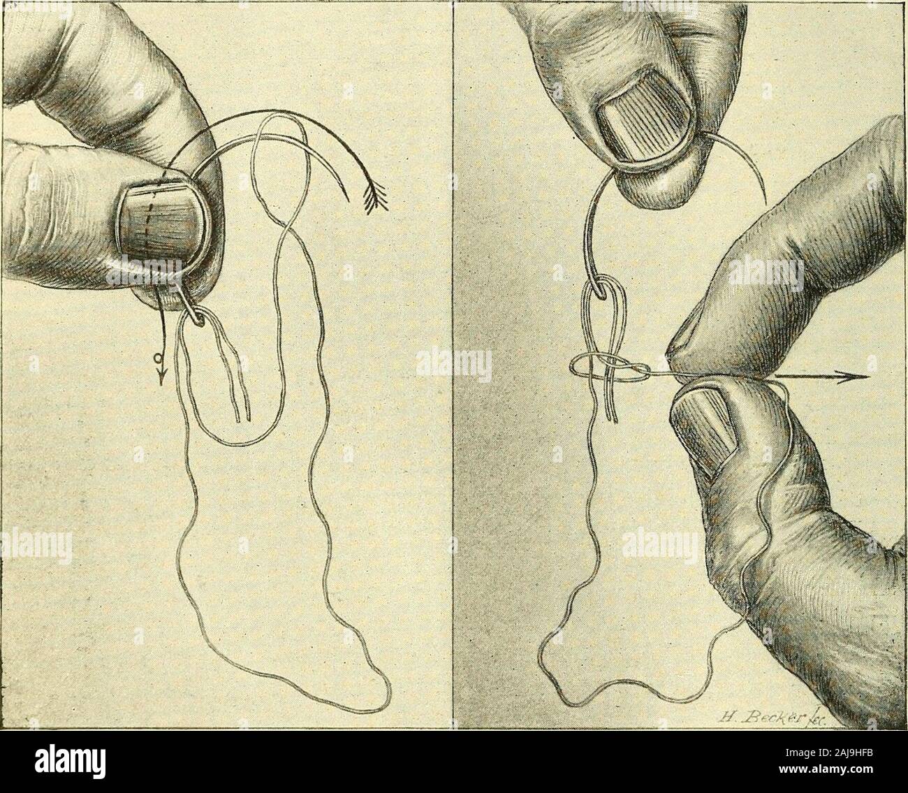 Gynecological instruments hi-res stock photography and images - Alamy