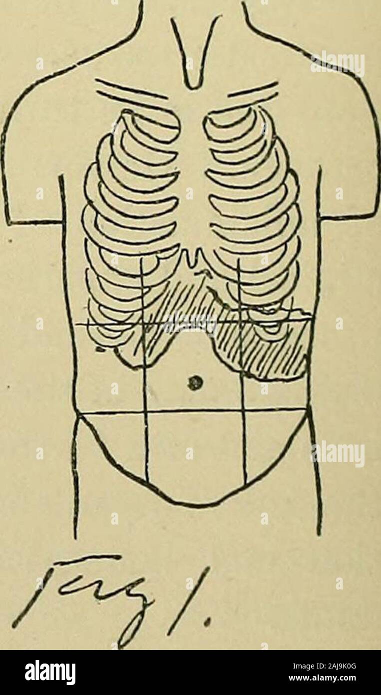 Epigastrium Stock Photos & Epigastrium Stock Images - Alamy