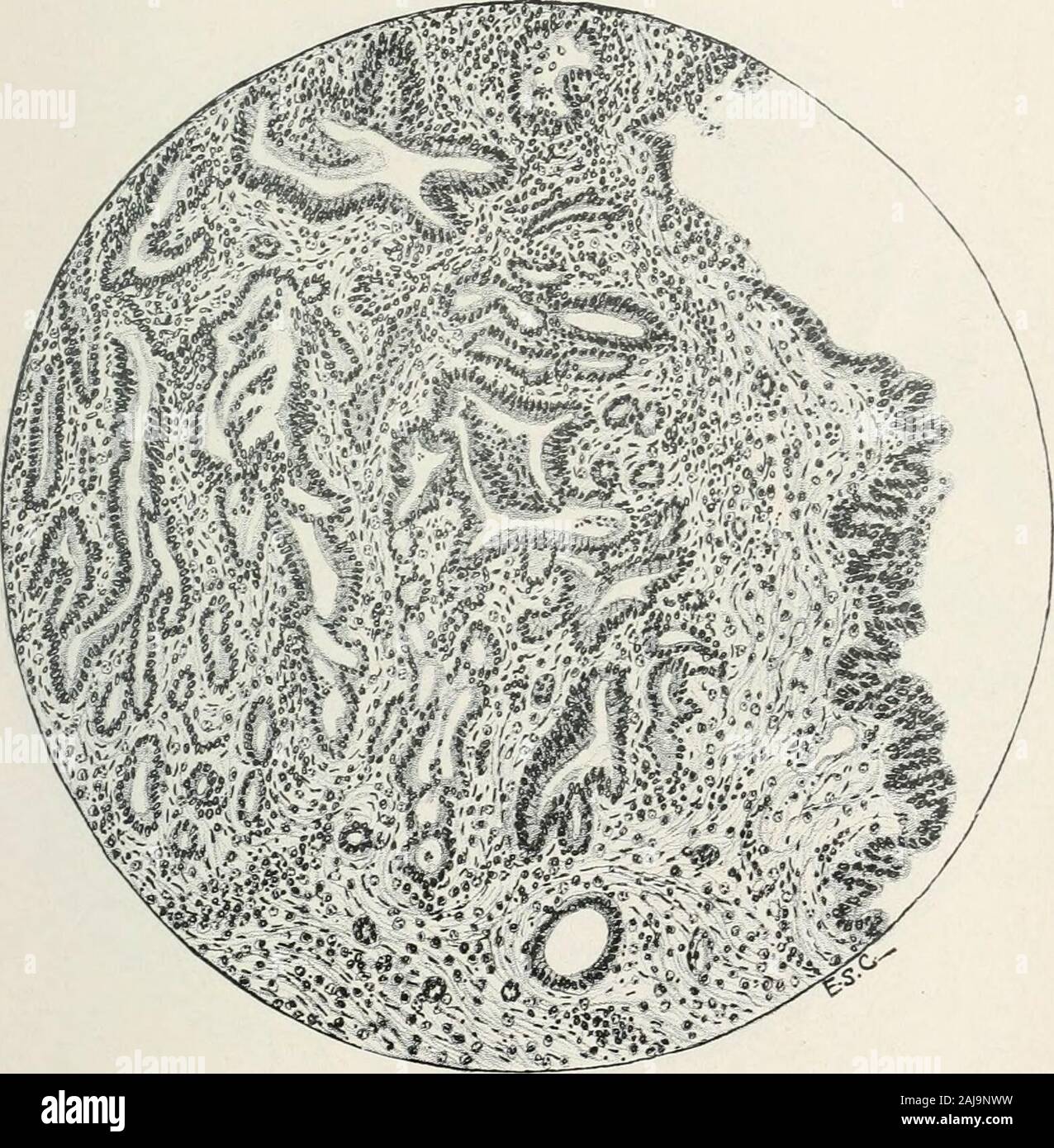 Annals of surgery . glands are irregular in shape and size, and are ...