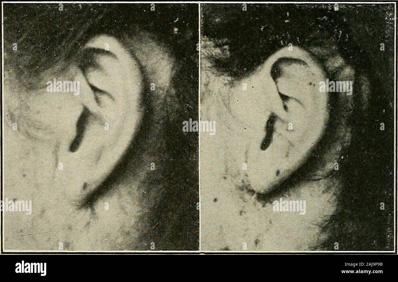 Notch in ear hi-res stock photography and images - Alamy