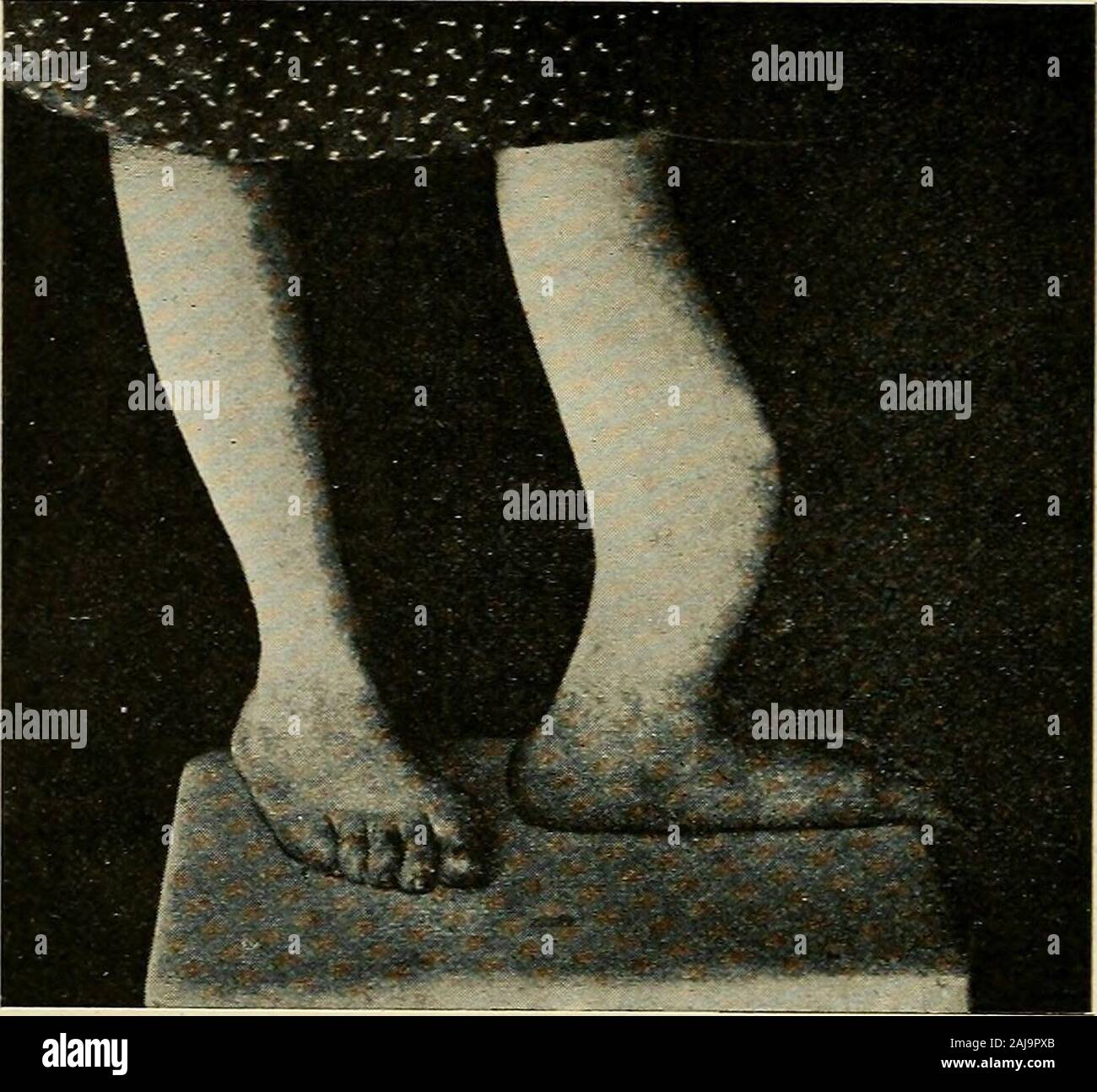 Anterior bowing hi-res stock photography and images - Alamy