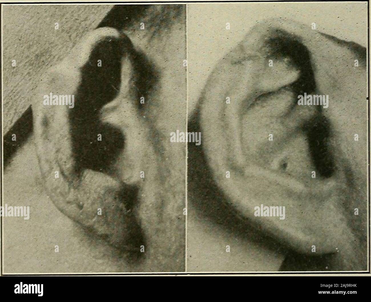 Sutured ear hi-res stock photography and images - Alamy