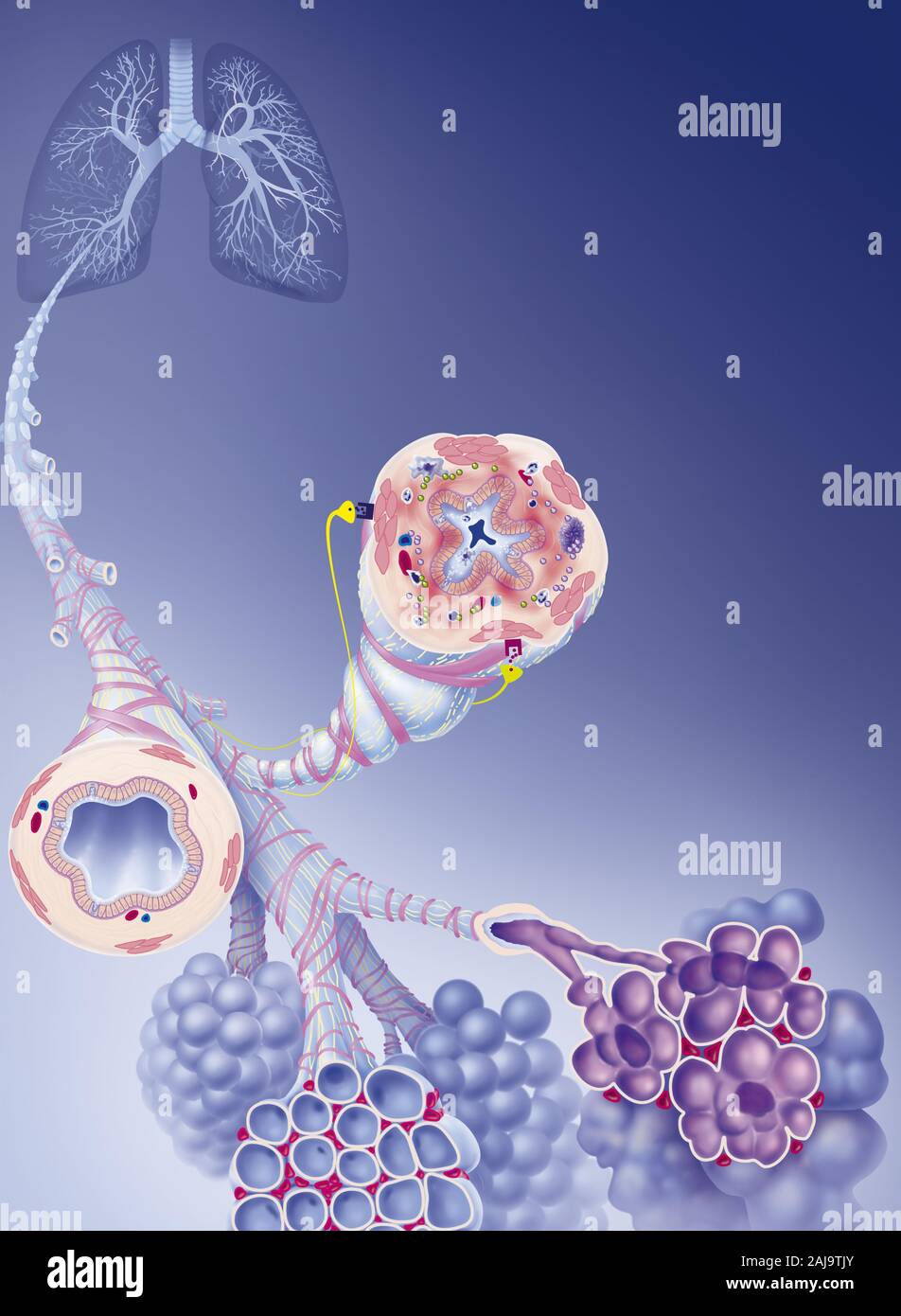 Chronic obstructive pulmonary disease hi-res stock photography and ...