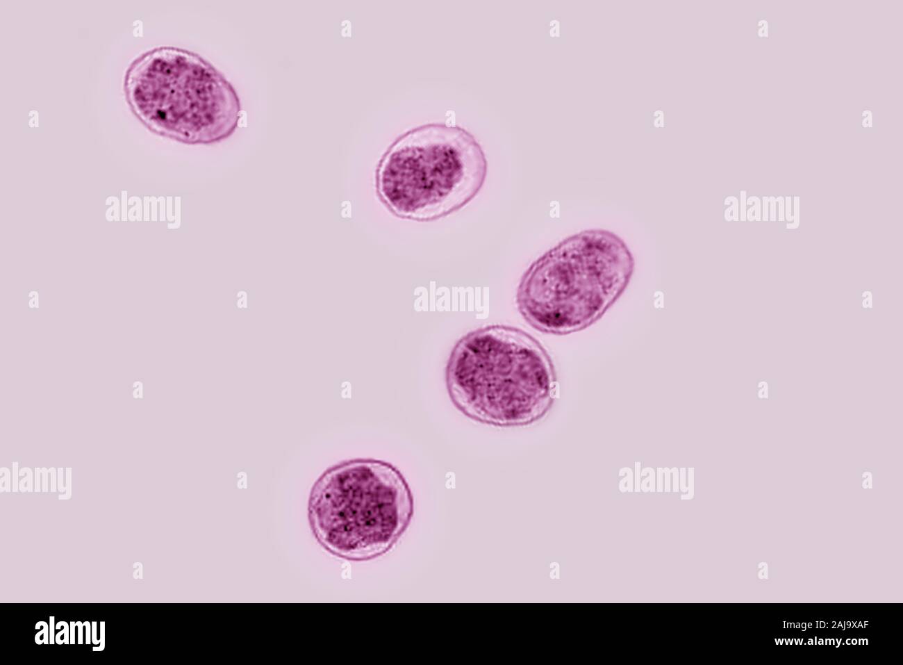 Coccobacillus hi-res stock photography and images - Alamy