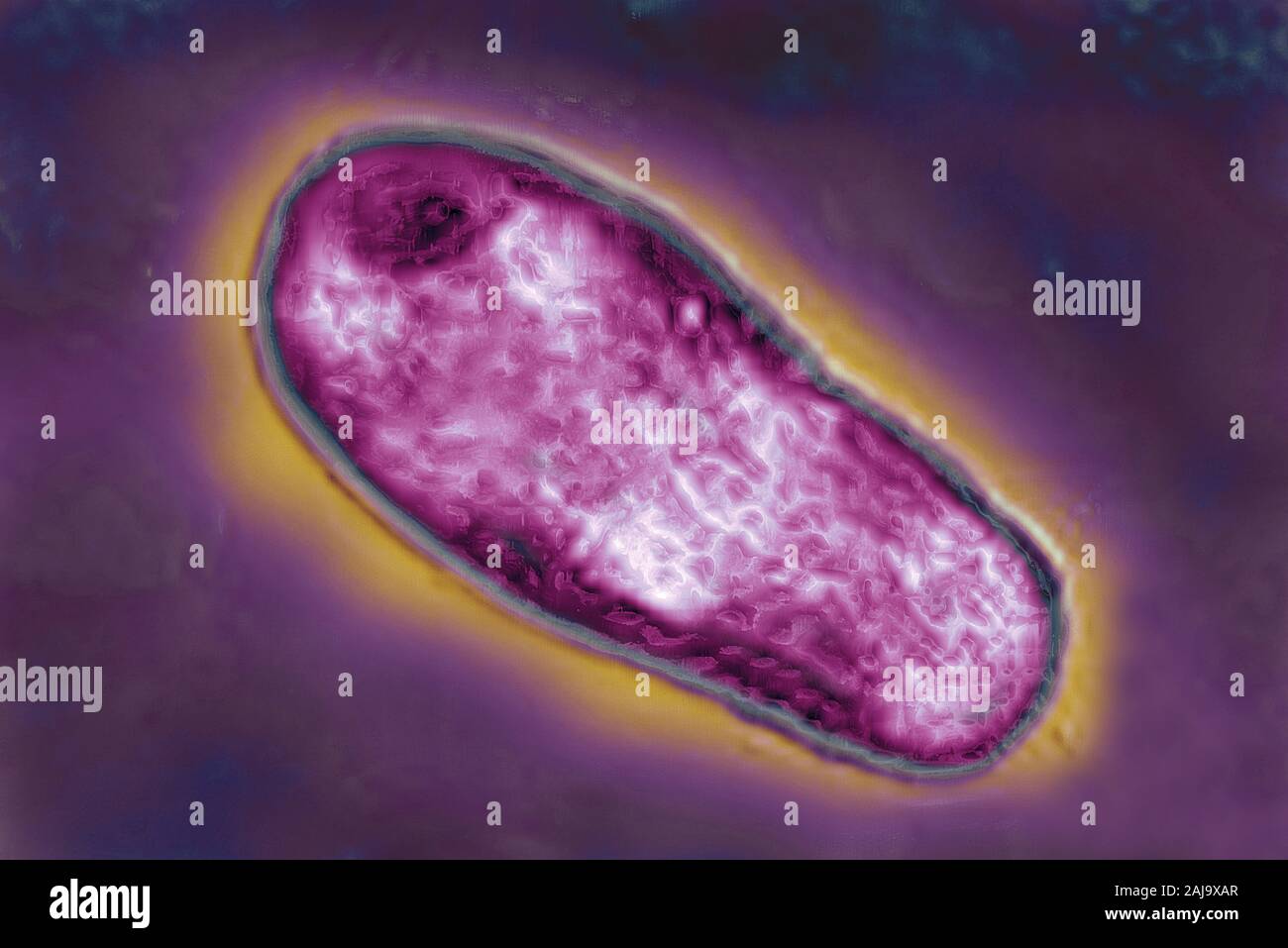 Brucellosis High Resolution Stock Photography and Images - Alamy