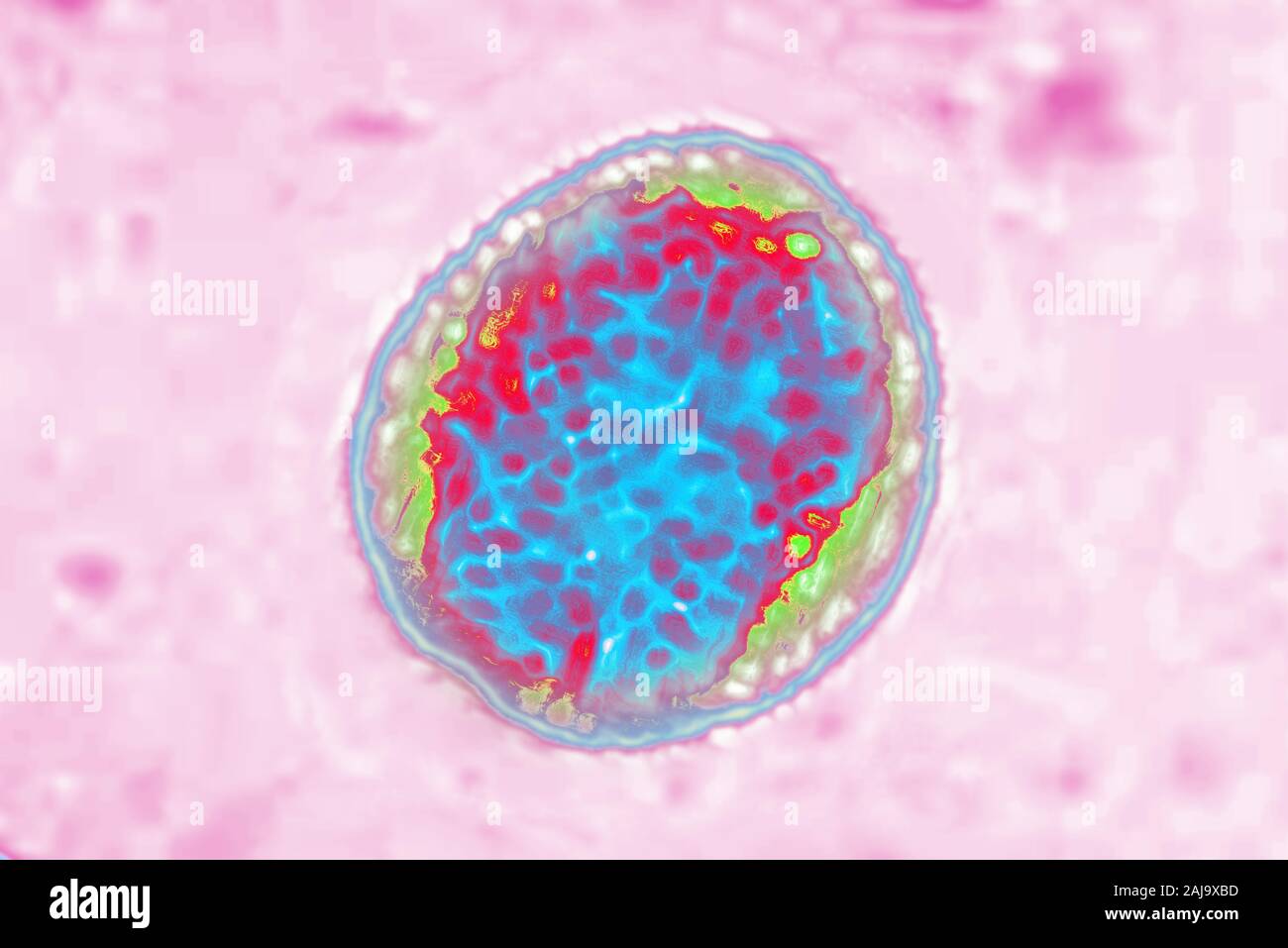 Coccobacillus hi-res stock photography and images - Alamy