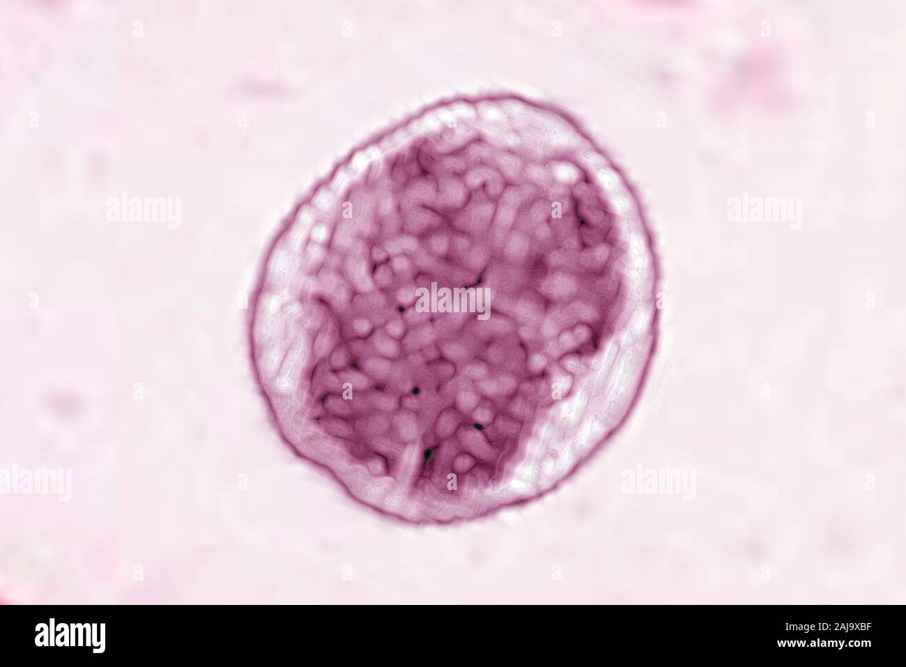 Cocci bacteria light microscope hi-res stock photography and images - Alamy