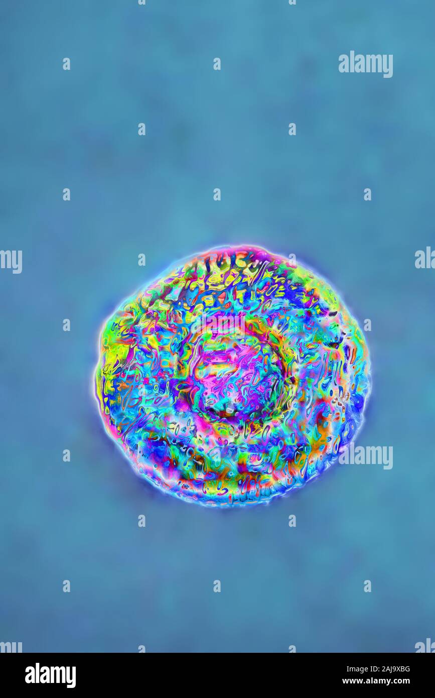 Mycoplasma genitalium bacteria hi-res stock photography and images - Alamy