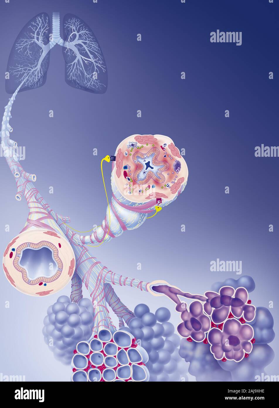 Lung tissue emphysema alveoli hi-res stock photography and images - Alamy